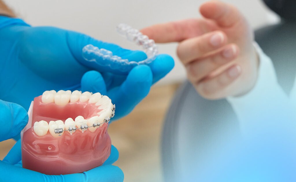 Clear Aligner Vs Invisalign - All You Need To Know