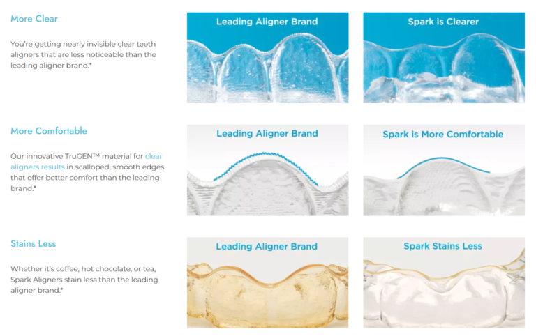 Review of Clear Aligners Spark - PROs and CONs, price, FAQ